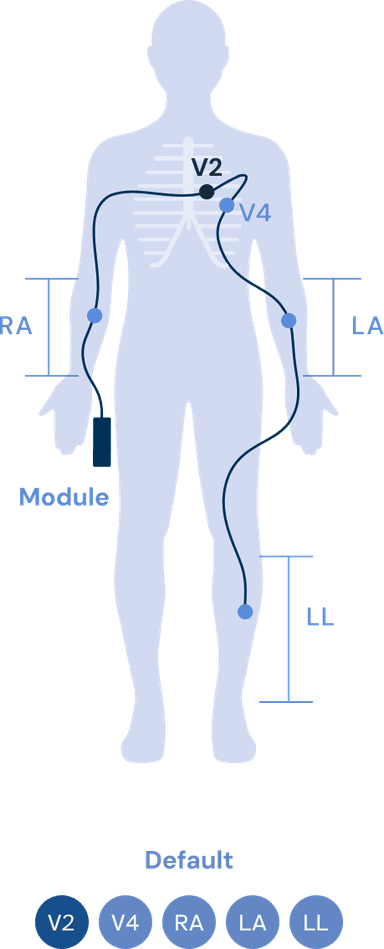 12-Lead Portable ECG Device in India - Kardia 12L | AliveCor India